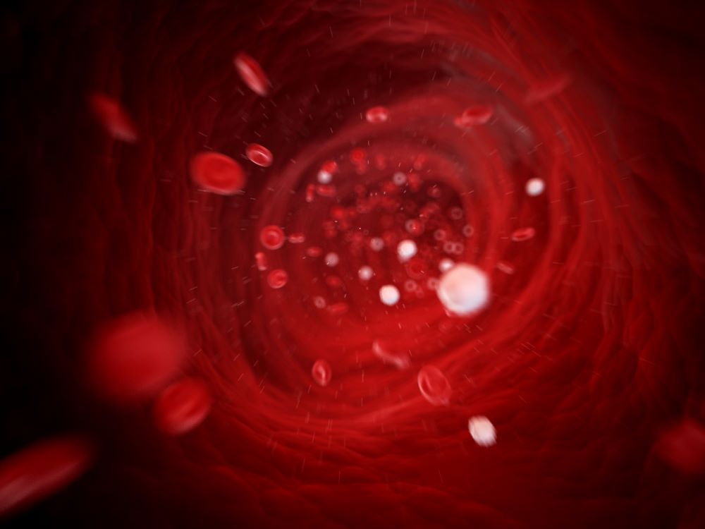 Preventing DVT - Stem-Kine